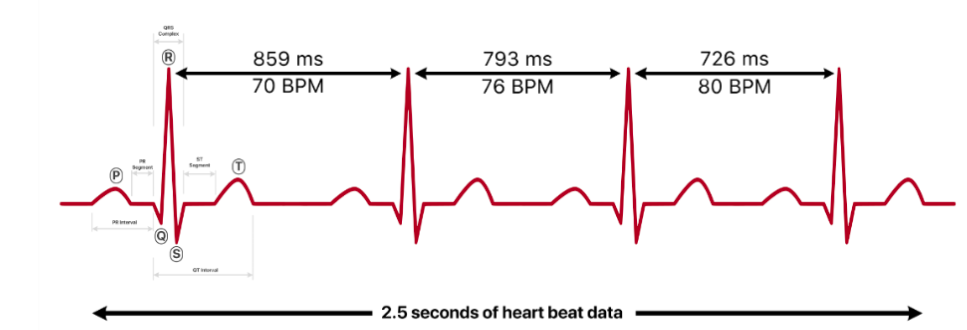 Wat is hartcoherentie? - Biofeedback Vereniging Nederland